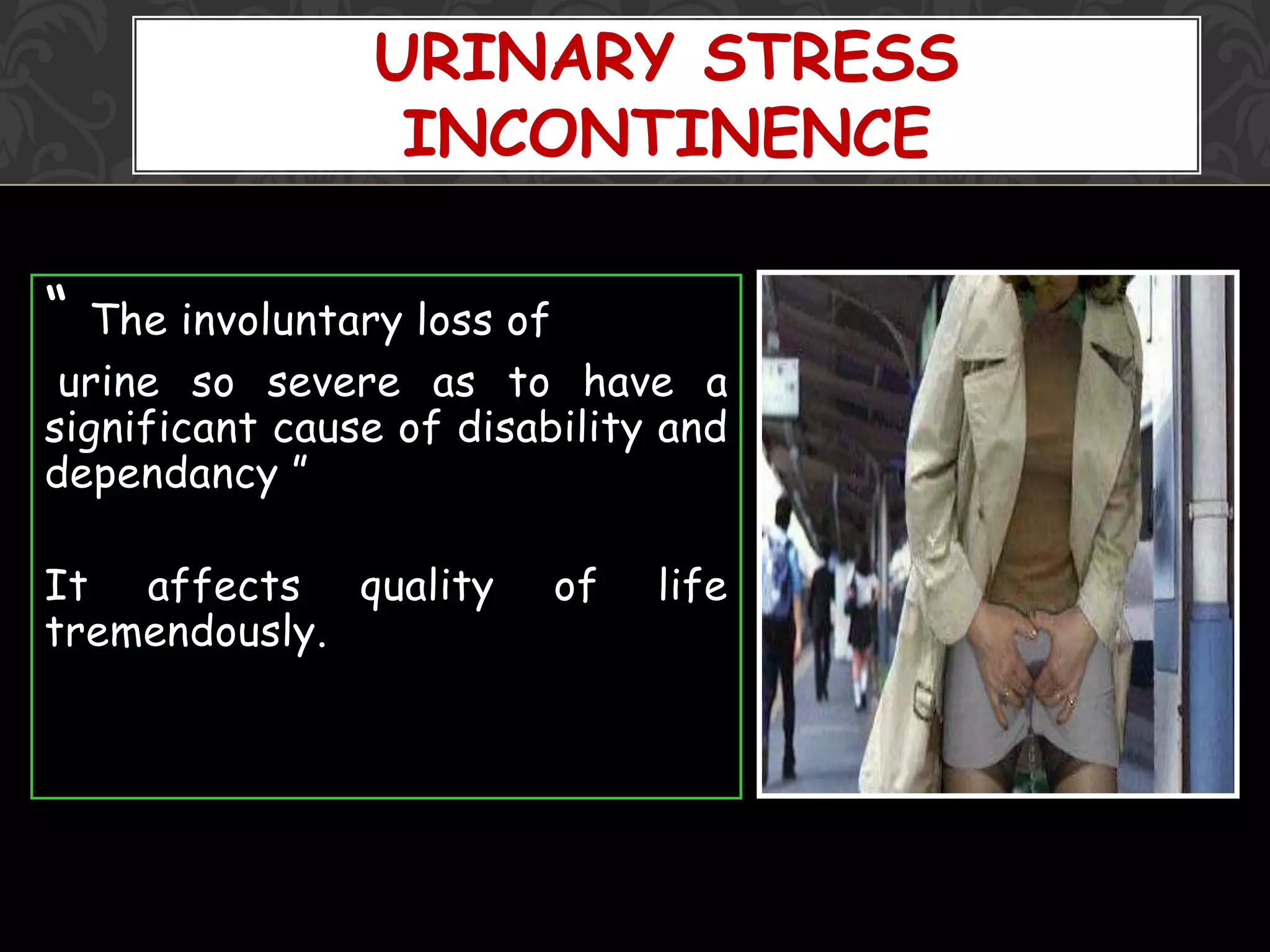 Urinary Stress Incontinence In Women | PDF
