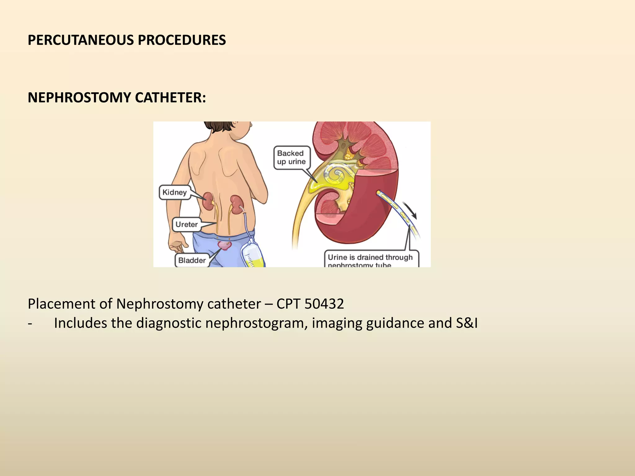 URINARY SURGERY (1).pdf