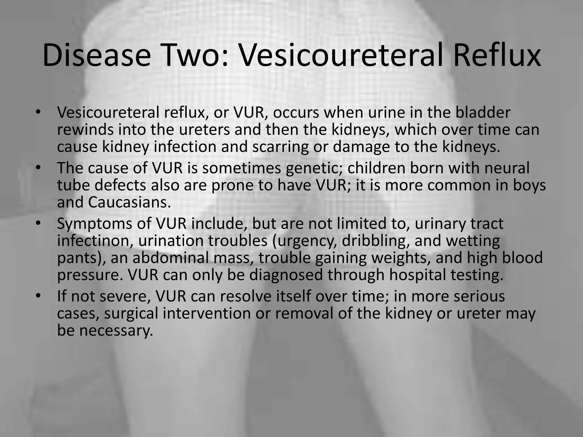 Urinary system | PPTX