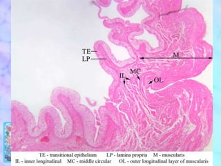 Labeled Bladder Slide