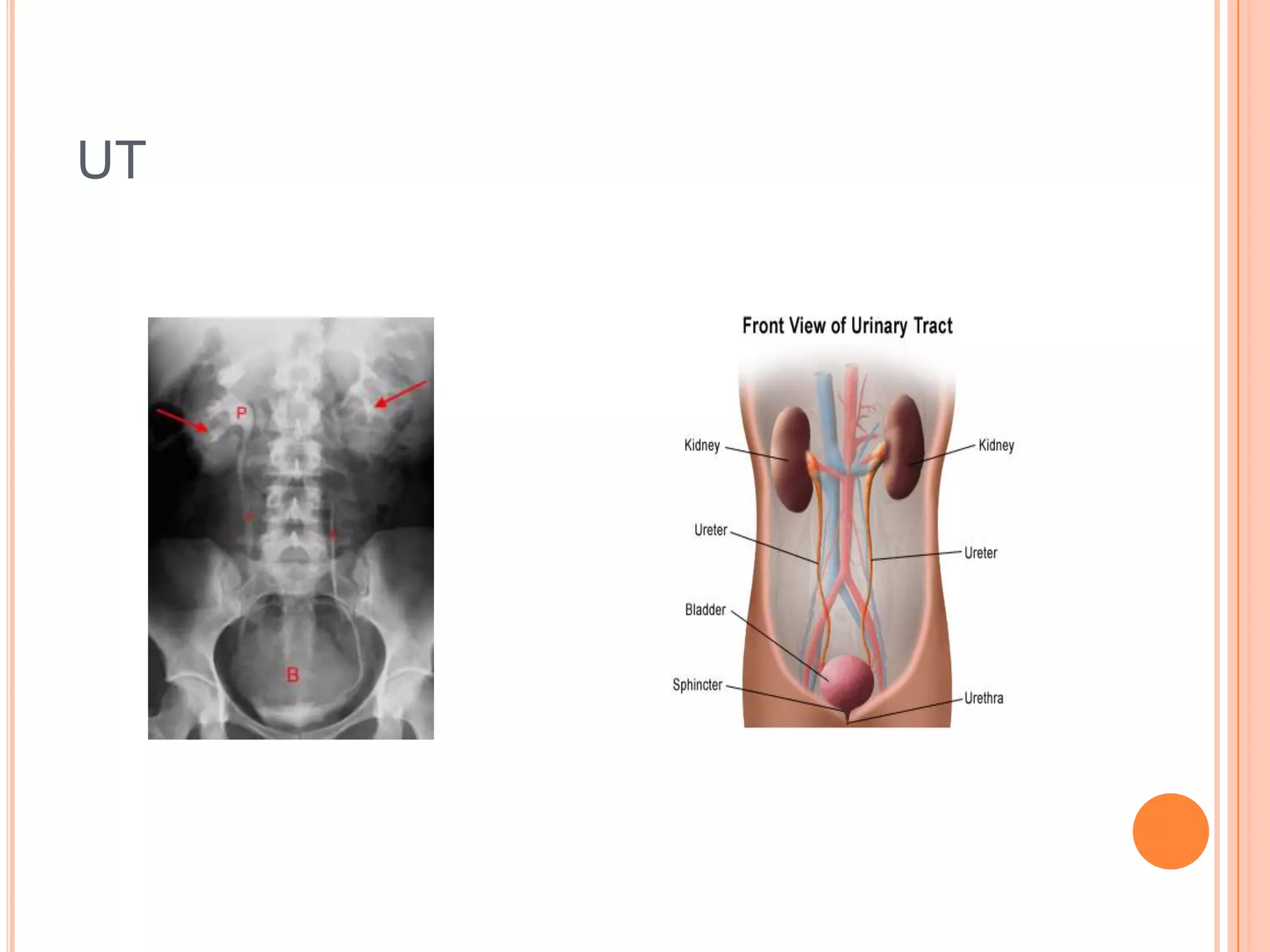 Urinary system | PPT