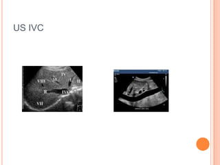 Urinary system | PPT