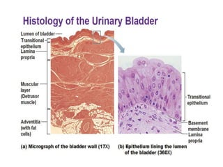 Bladder Slide Labeled