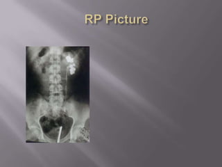 Urinary system abbreviations | PPTX | Endocrine and Metabolic Diseases ...