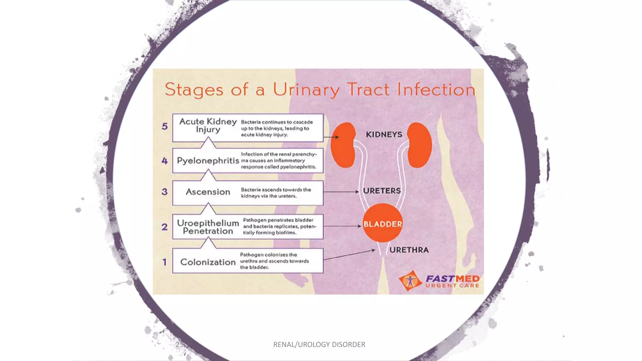 Urinary system disorder | PPTX