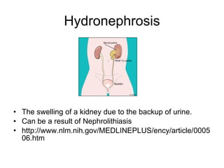 Urinary System Disorders | PPT