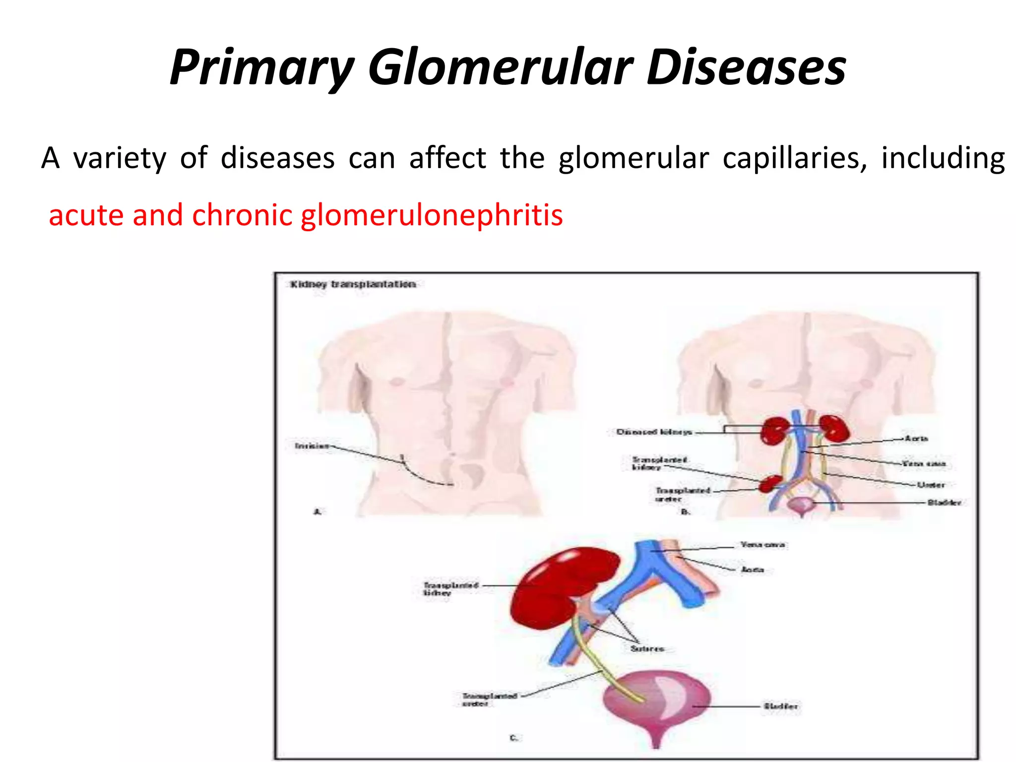 Urinary system disorders.pptx