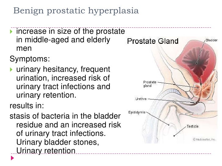 Urinary system disorders.pptx1