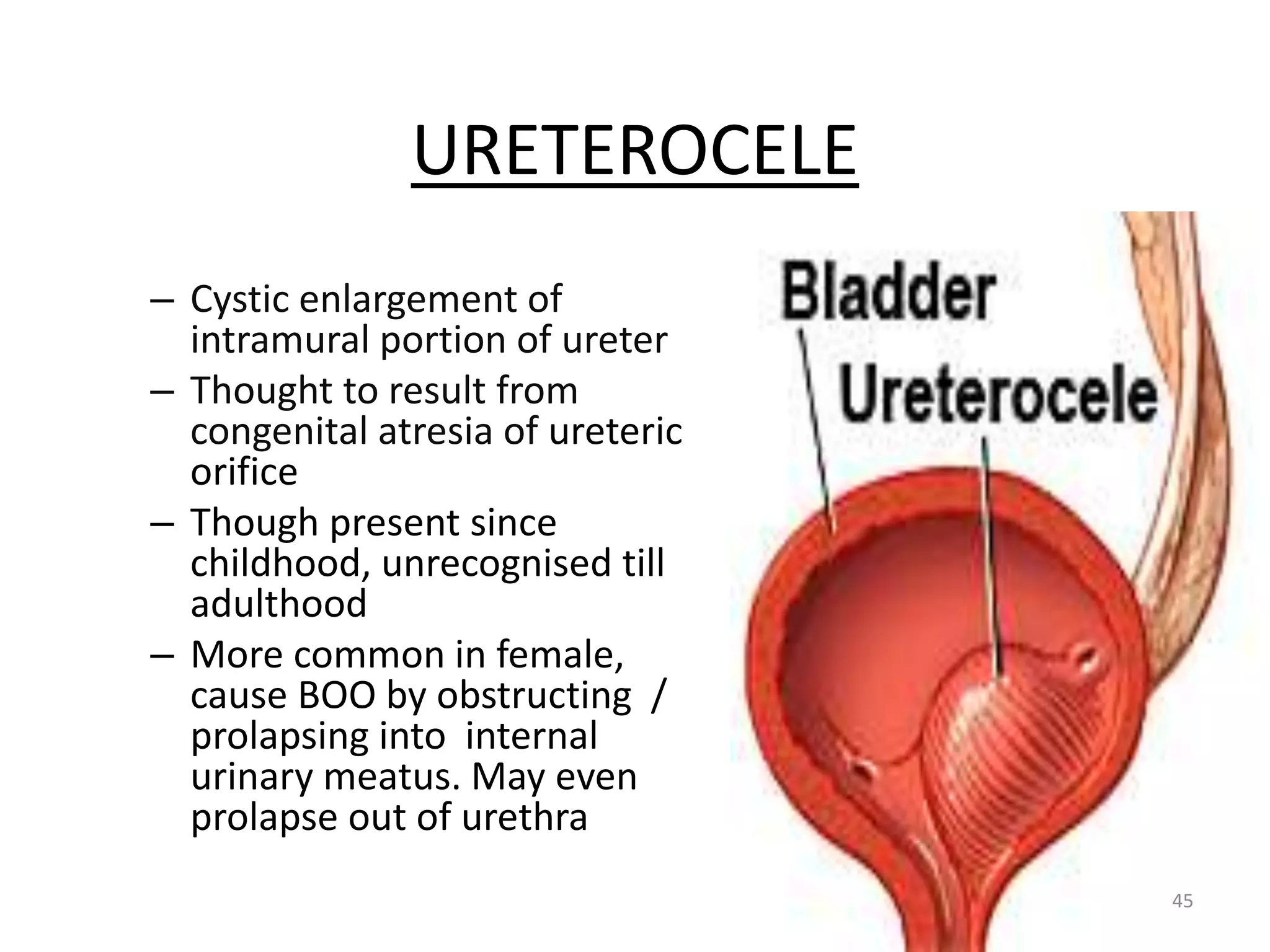 Urinary system embryology | PPTX