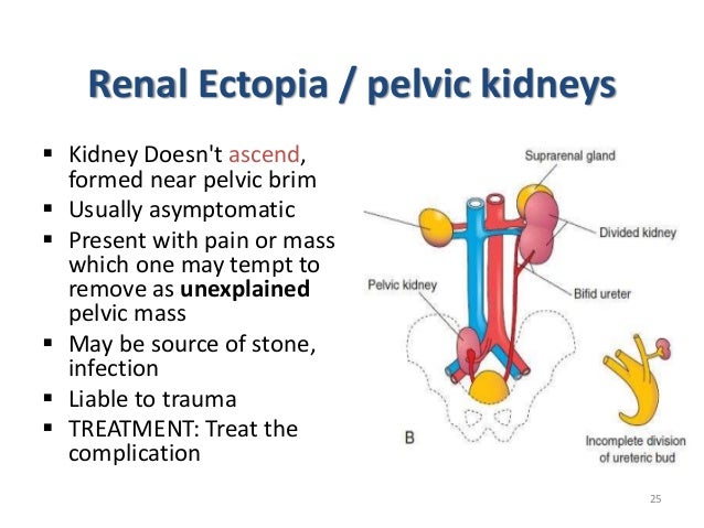 Urinary system embryology