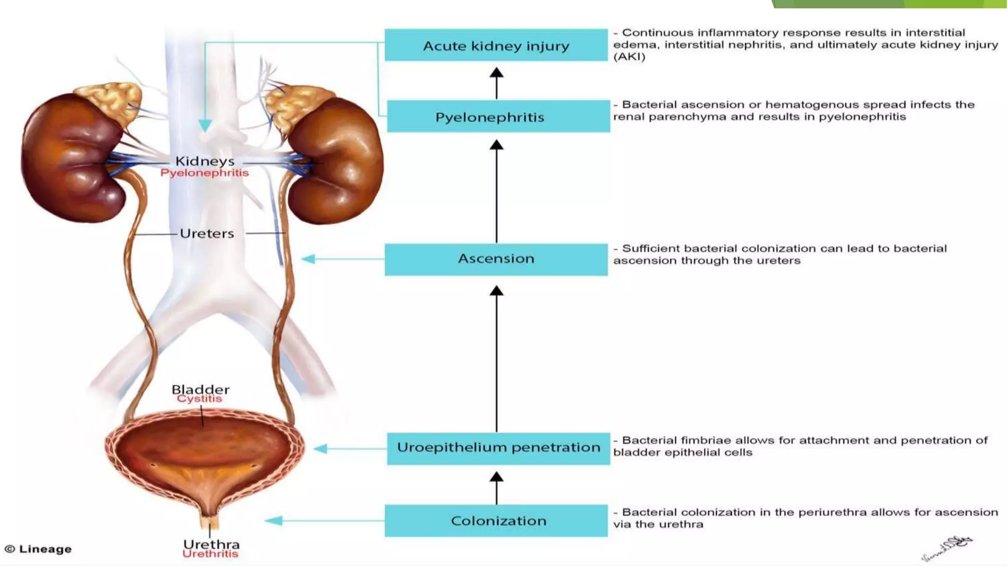 Urinary tarct infection | PPTX