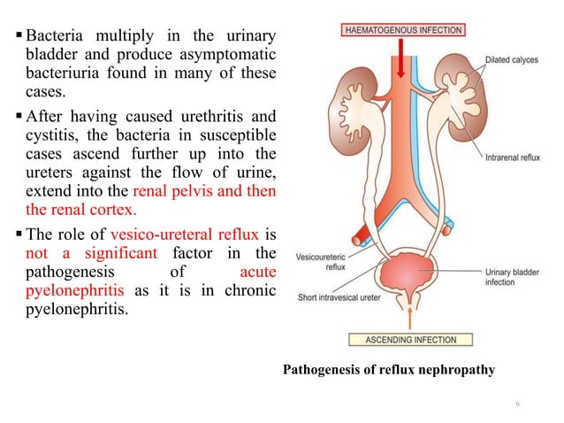 urinary track infection etiology ,cystitis,acute chronic pyelonephritis ...