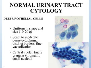 urinarytract-180126143744.pptx