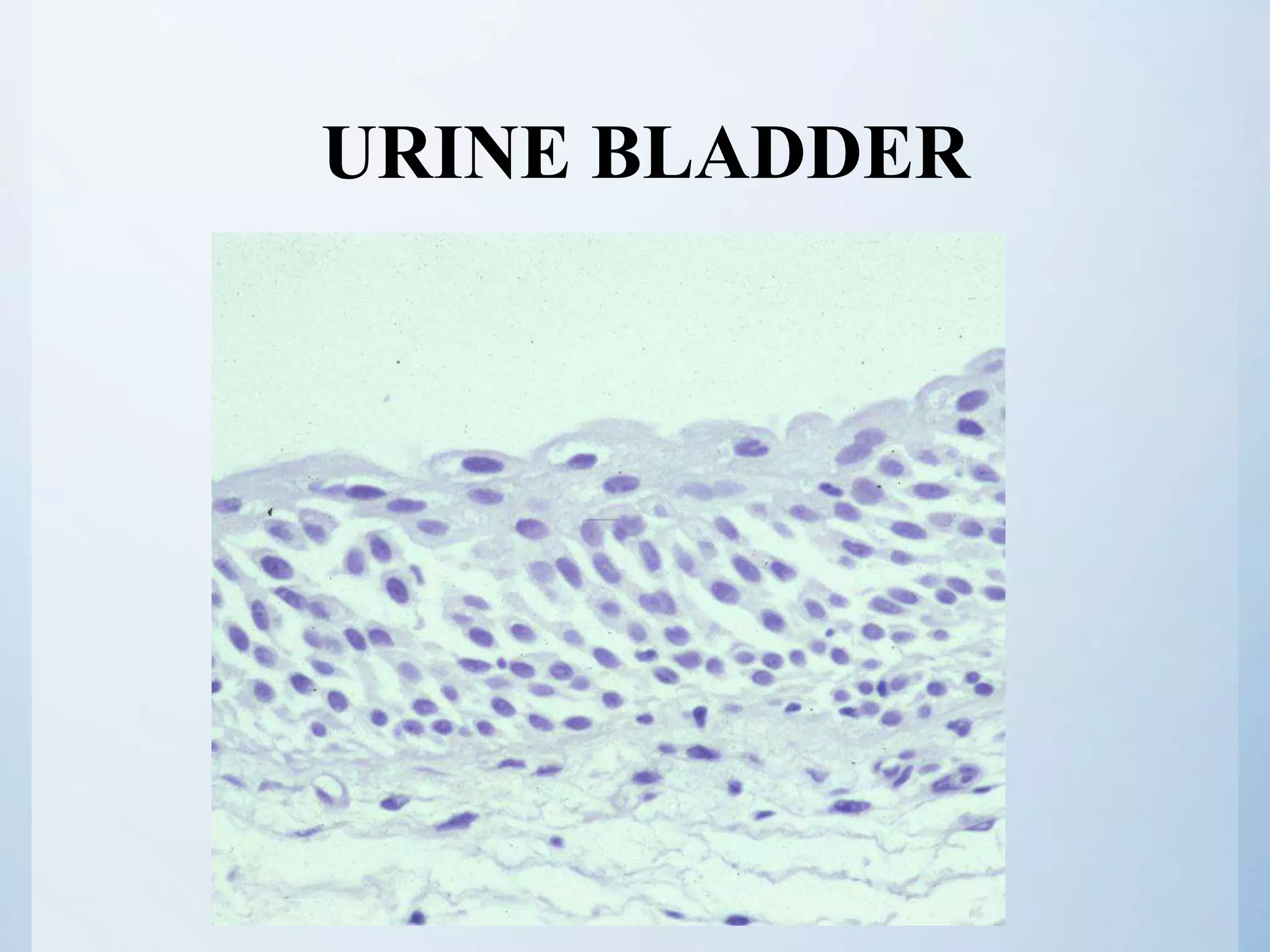 cytology of urinary tract | PPTX