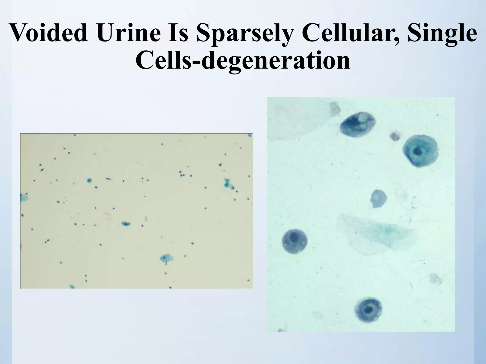 cytology of urinary tract | PPTX