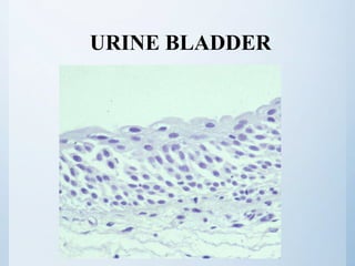 Bladder Slide