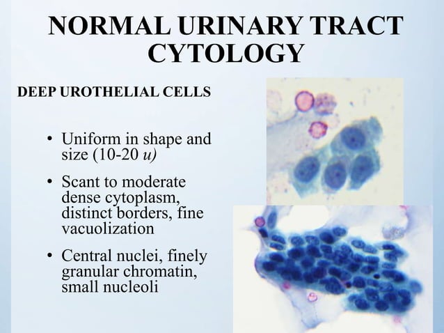 cytology of urinary tract | PPTX | Biological Sciences | Science