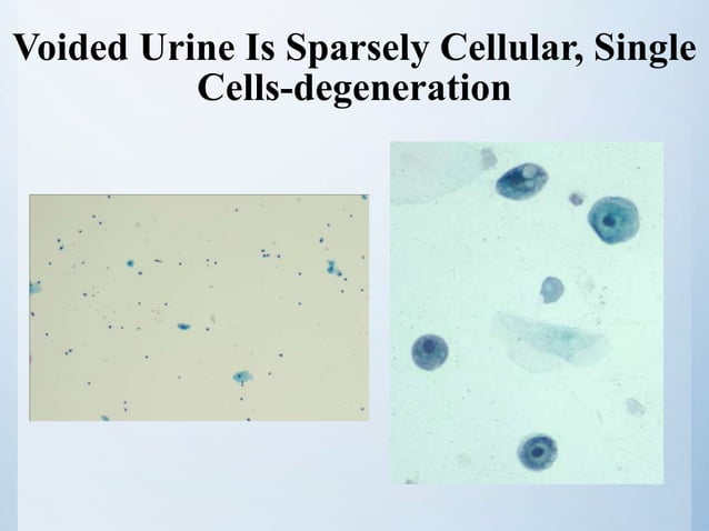 cytology of urinary tract | PPTX | Biological Sciences | Science