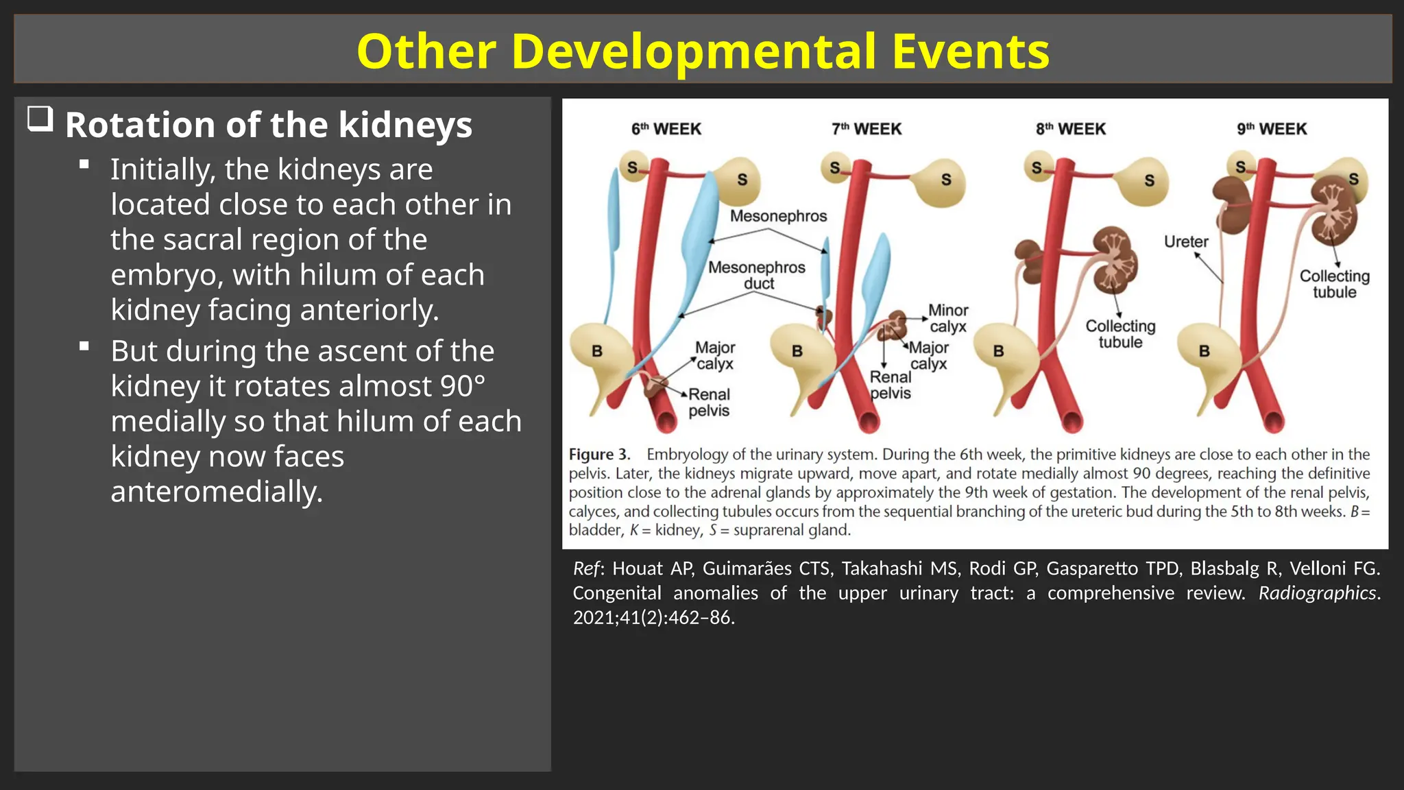 Anatomy of Urinary Tract and Congenital Anomalies – A Radiology ...