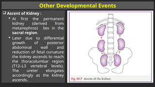 Anatomy of Urinary Tract and Congenital Anomalies – A Radiology ...