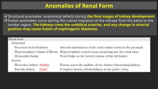 Anatomy of Urinary Tract and Congenital Anomalies – A Radiology ...