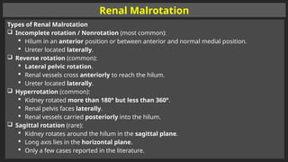 Anatomy of Urinary Tract and Congenital Anomalies – A Radiology ...