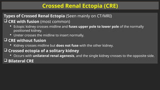 Anatomy of Urinary Tract and Congenital Anomalies – A Radiology ...