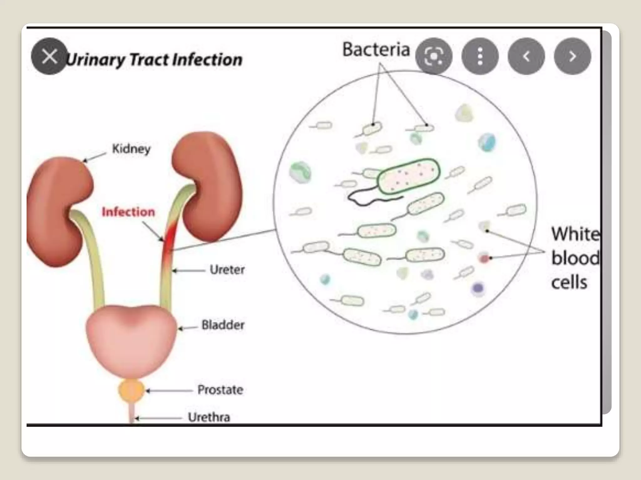 URINARY TRACT ANTI-INFECTIVE AGENTS.pptx