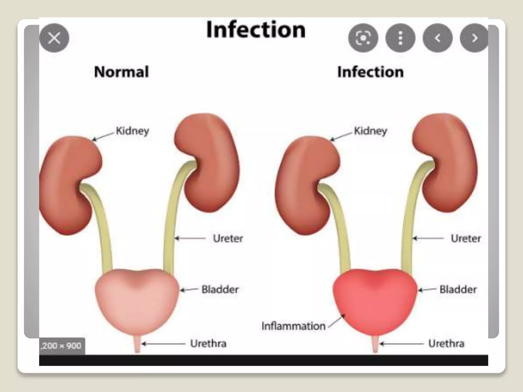 URINARY TRACT ANTI-INFECTIVE AGENTS.pptx