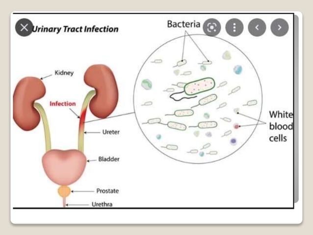 URINARY TRACT ANTI-INFECTIVE AGENTS.pptx