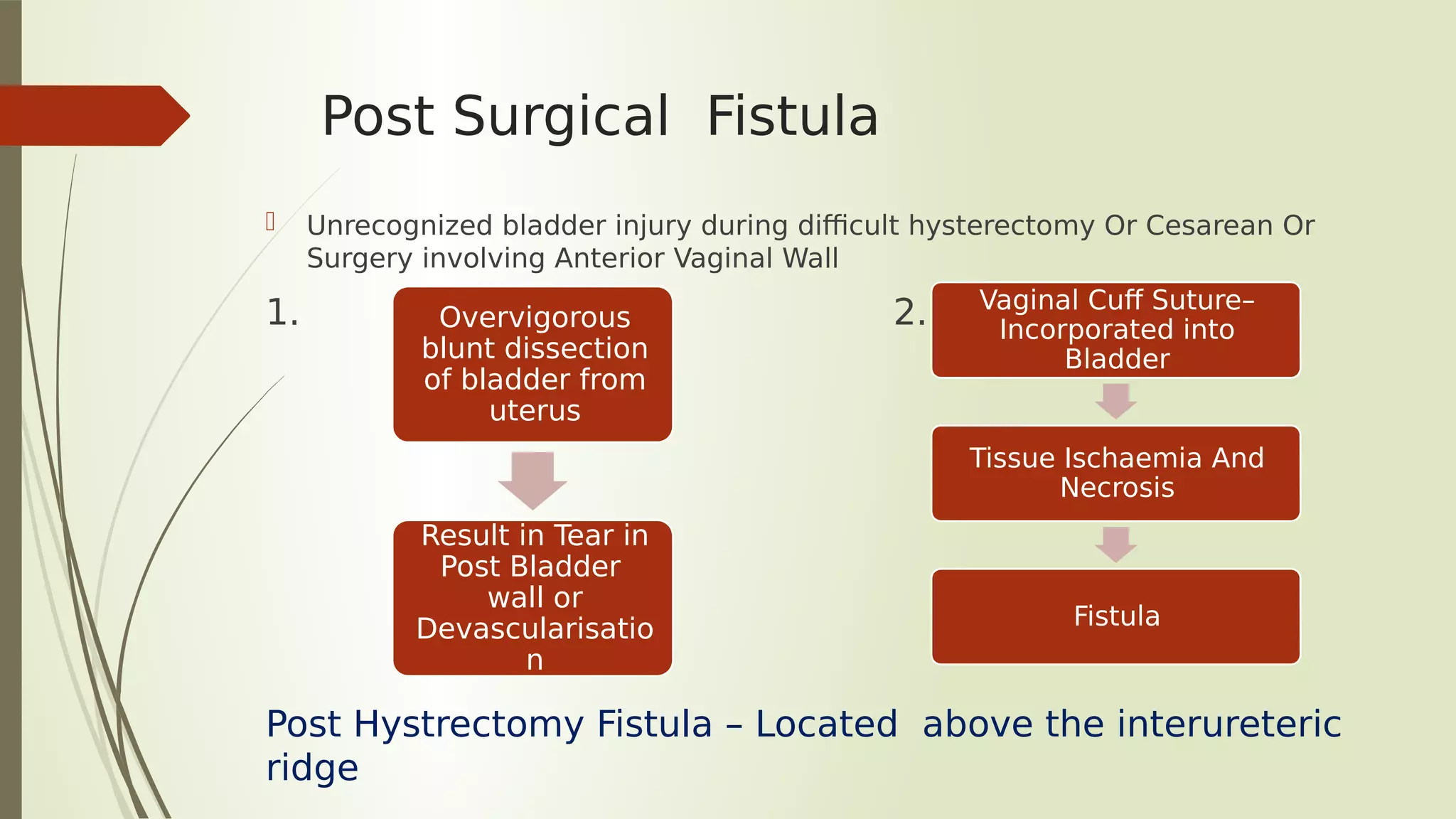 Urinary Tract Fistulas -(VVF) Etiology, Diagnosis, Management | PDF