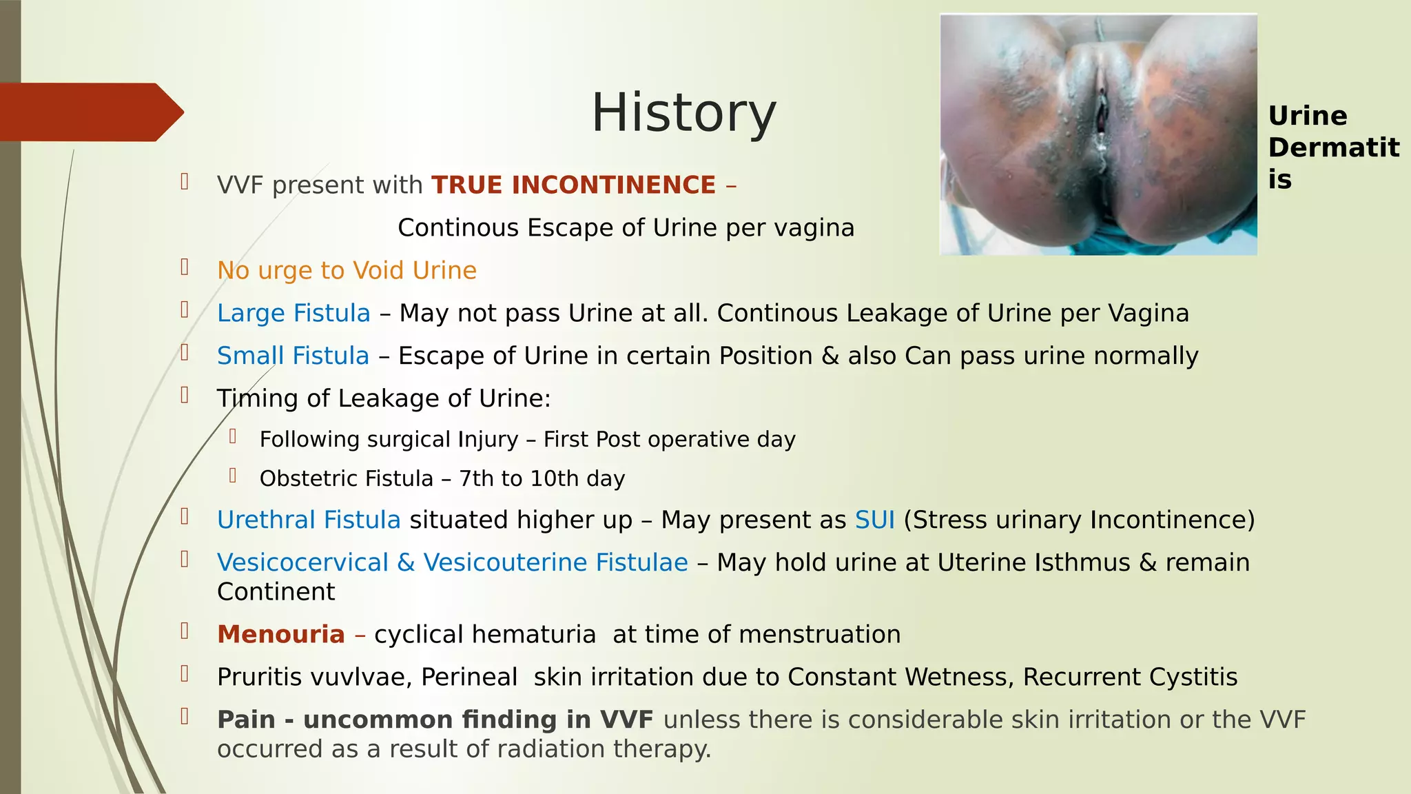 Urinary Tract Fistulas -(VVF) Etiology, Diagnosis, Management | PDF