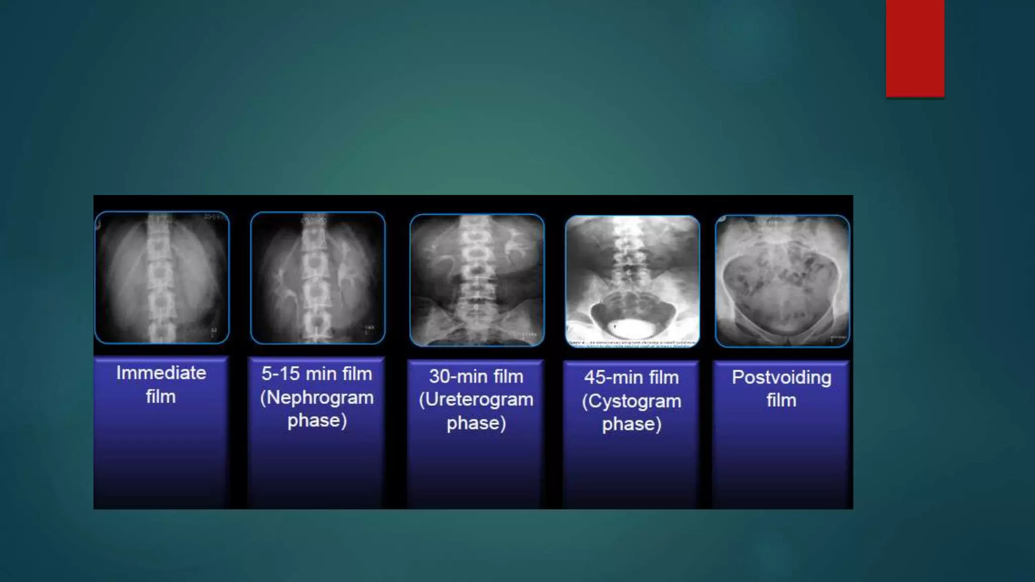 Urinary tract imaging and pathology | PPTX