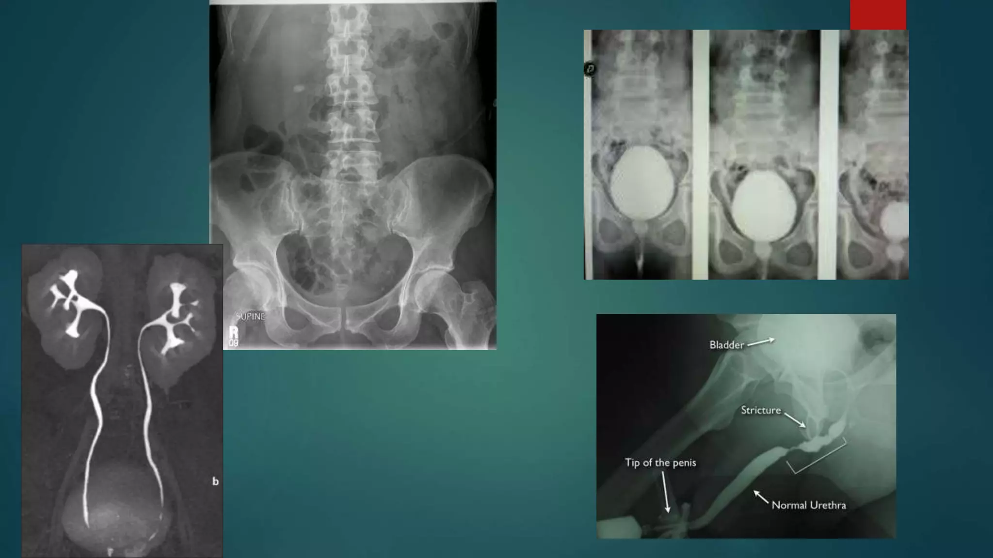 Urinary tract imaging and pathology | PPTX