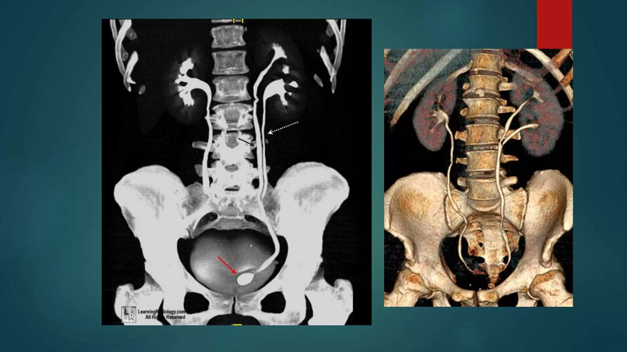 Urinary tract imaging and pathology | PPTX