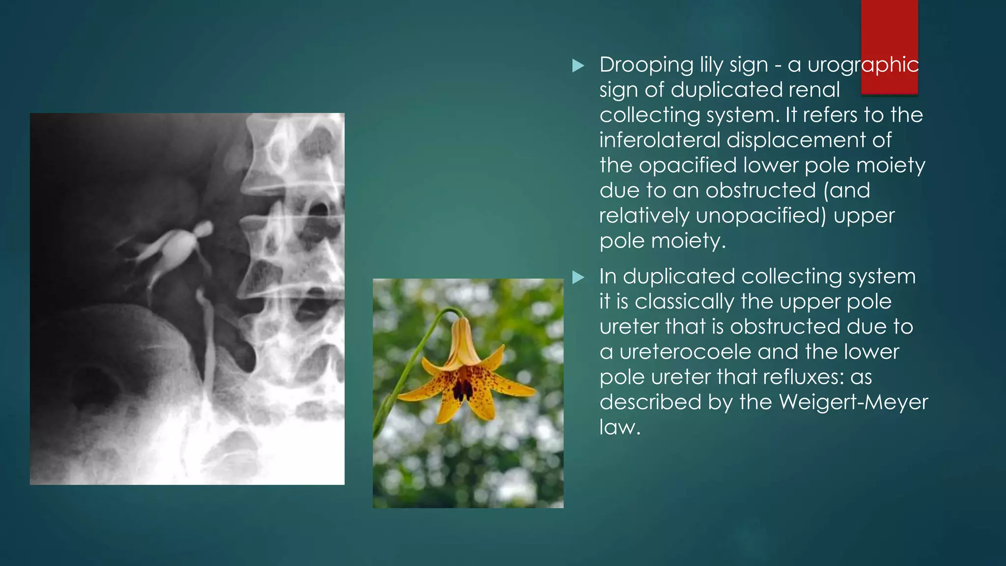 Urinary tract imaging and pathology | PPTX