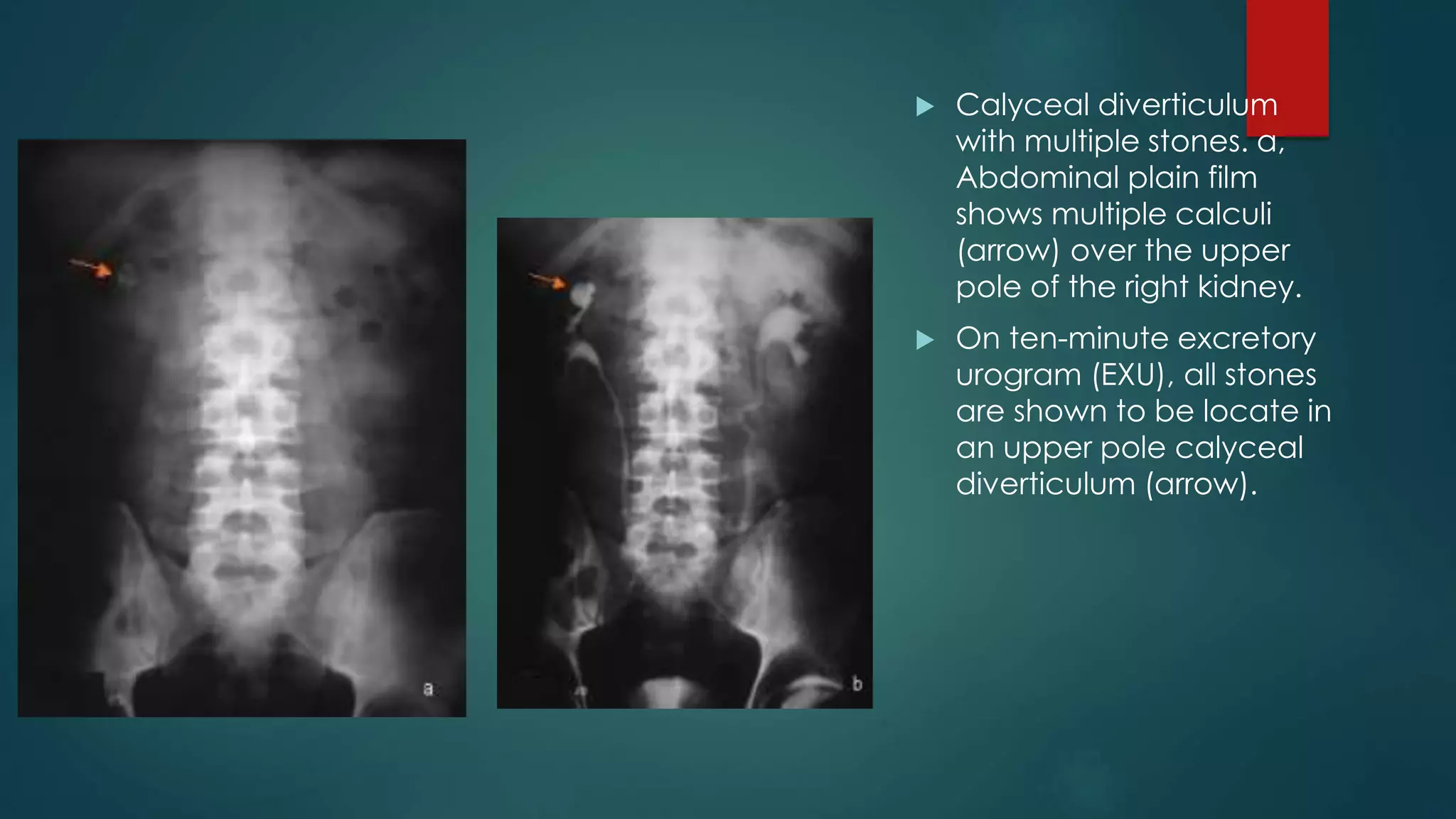 Urinary tract imaging and pathology | PPTX