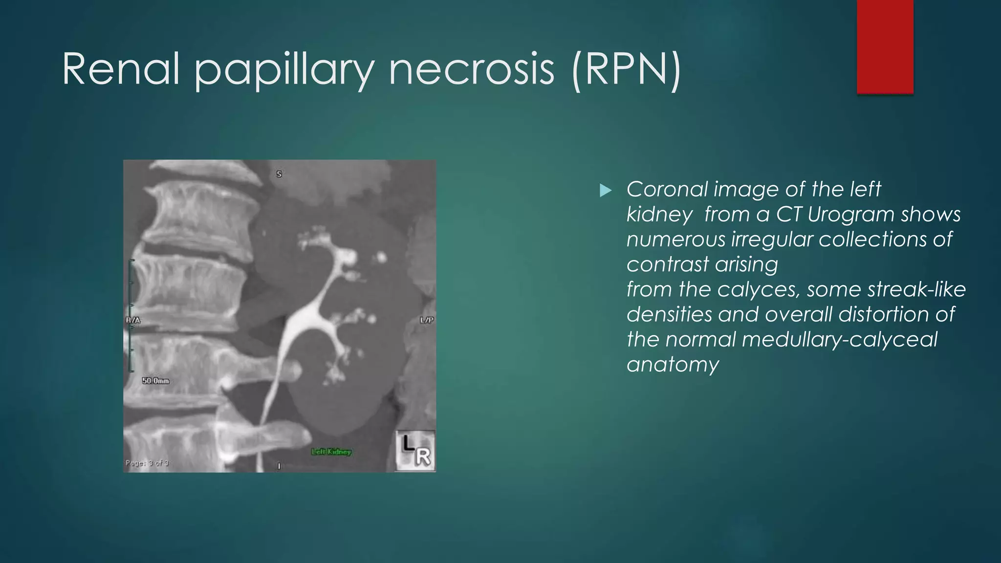 Urinary tract imaging and pathology | PPTX