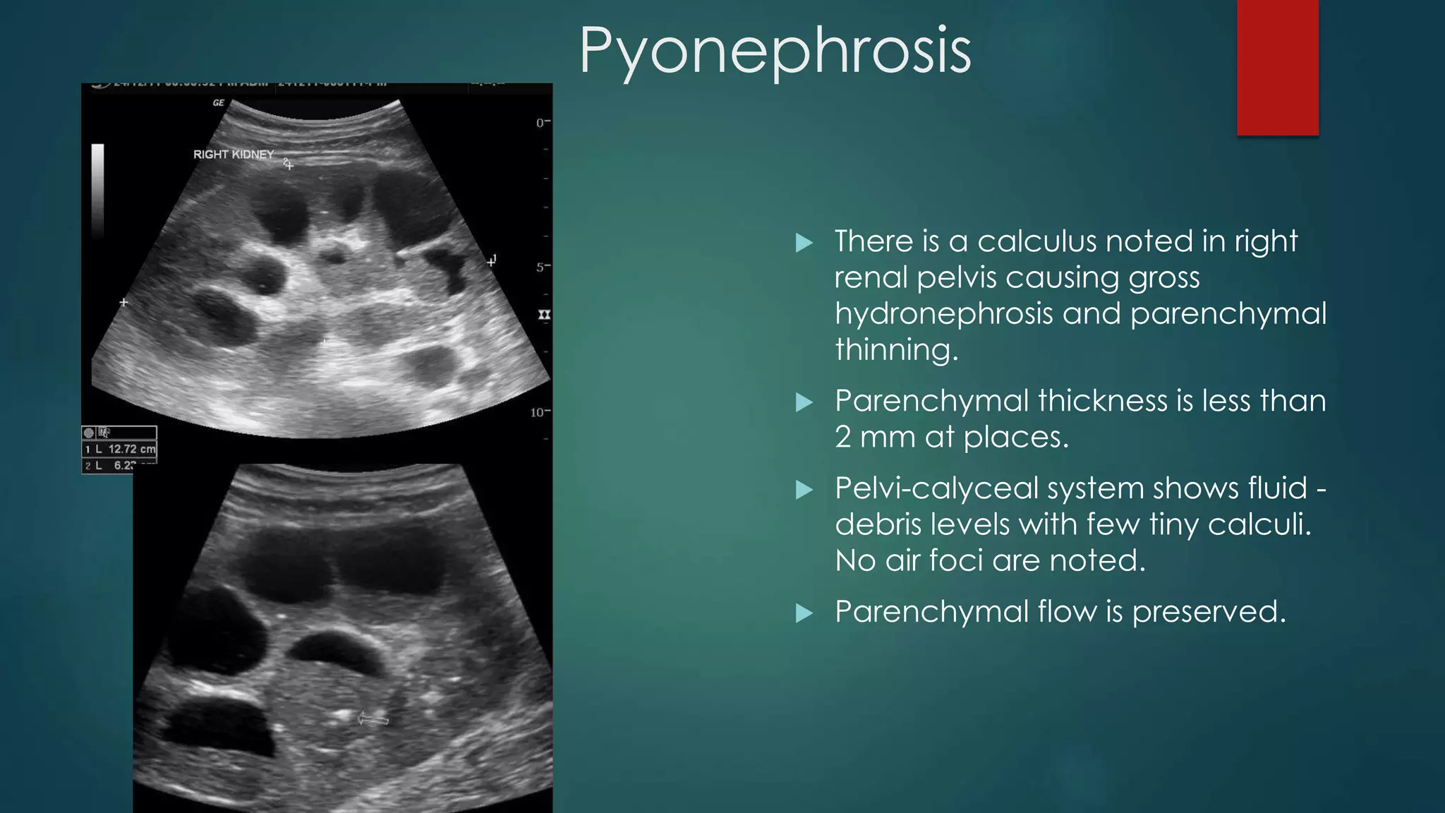 Urinary tract imaging and pathology | PPTX