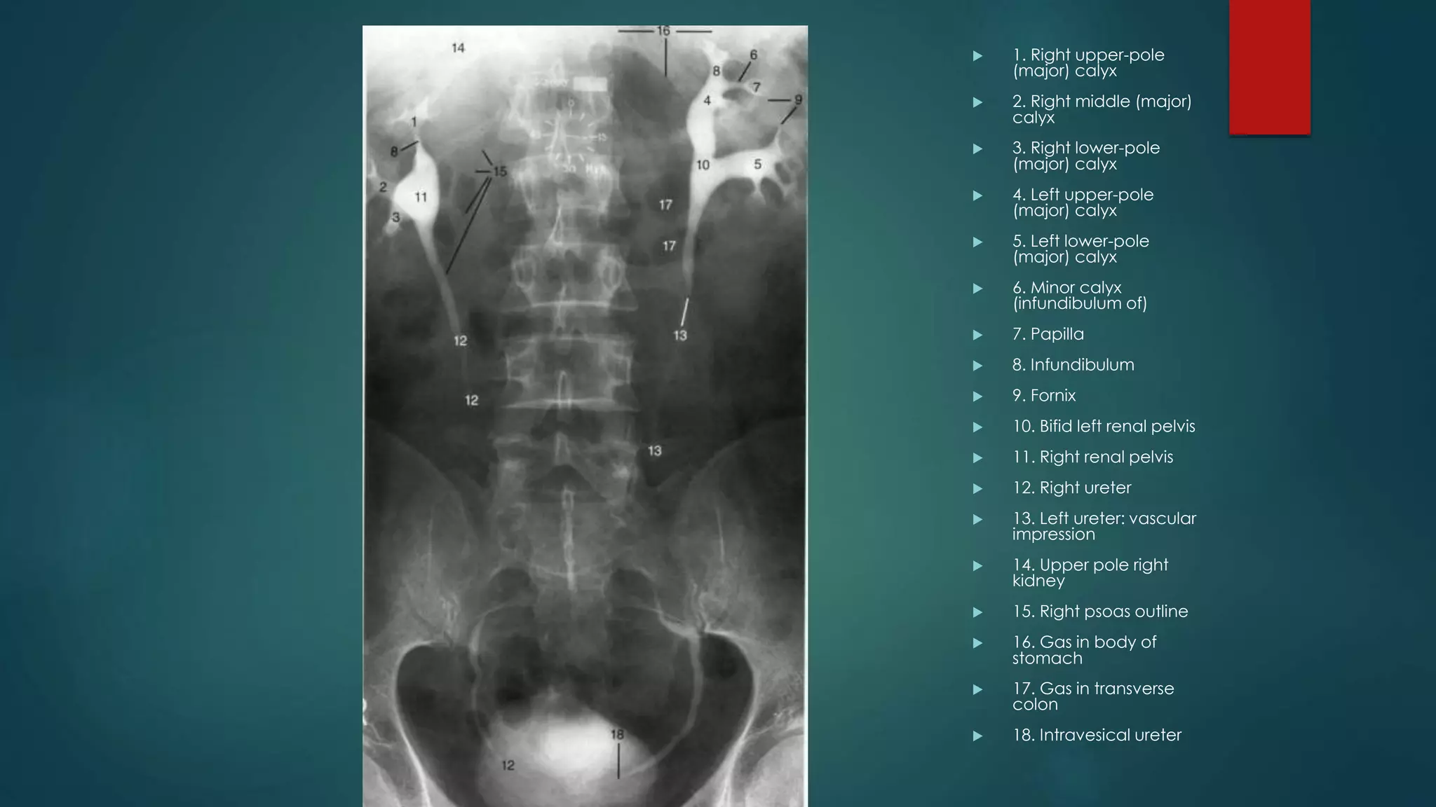 Urinary tract imaging and pathology | PPTX