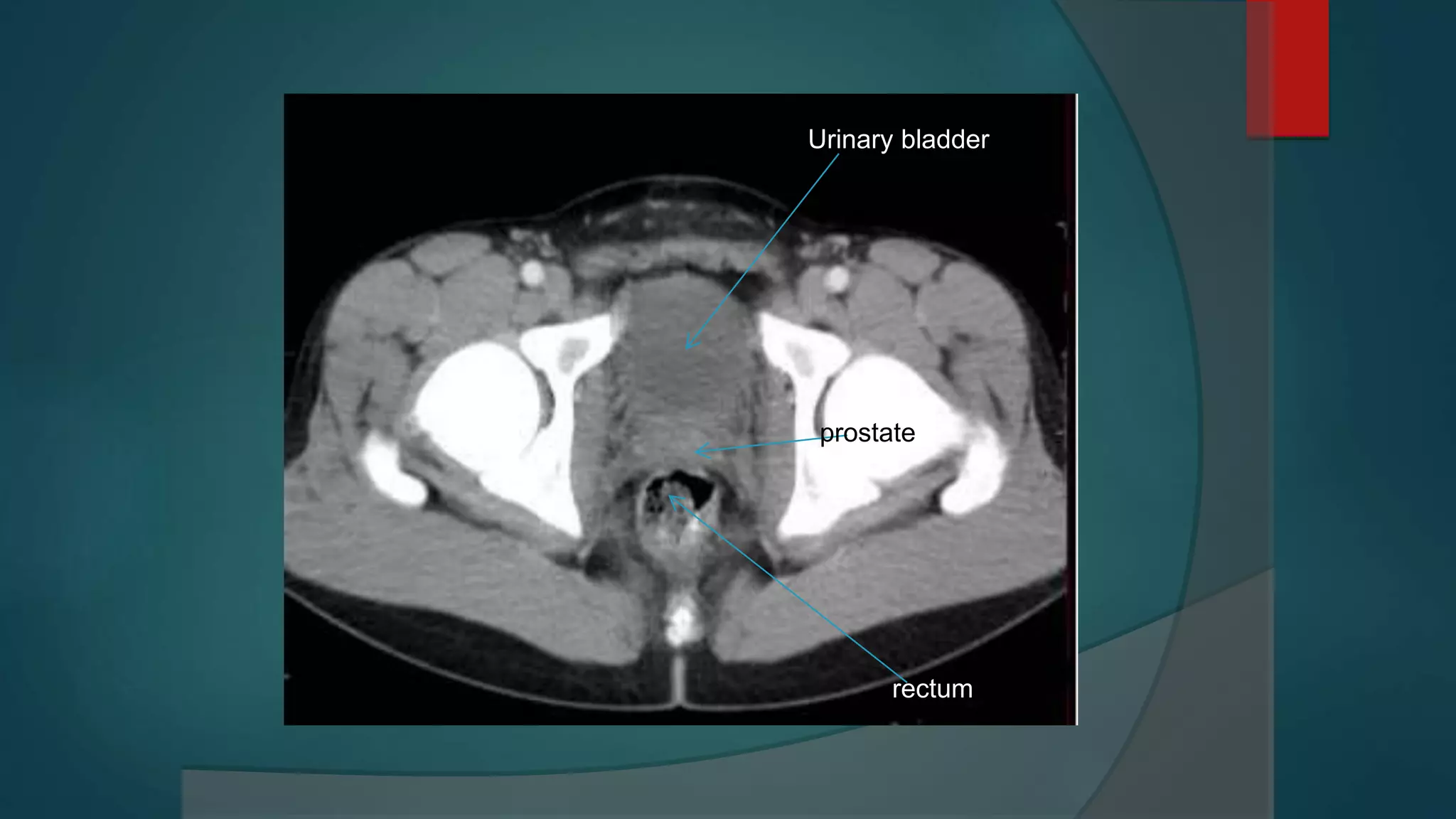 Urinary tract imaging and pathology | PPTX