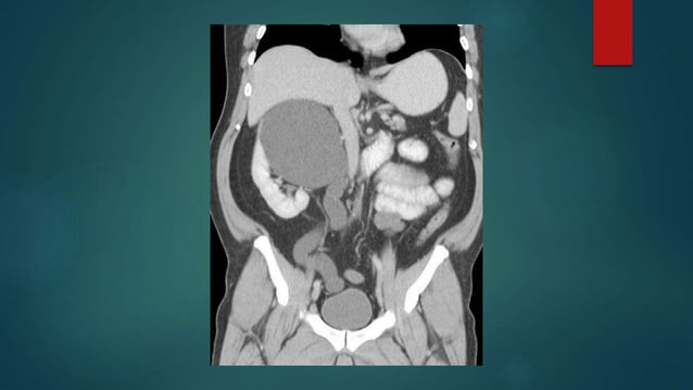 Urinary tract imaging and pathology | PPTX | Medical Health