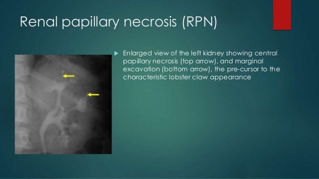 Urinary tract imaging and pathology