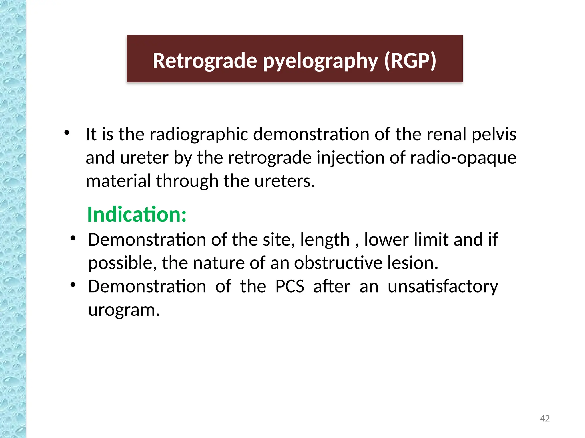 Urinary Tract Imaging by joginder .pptx