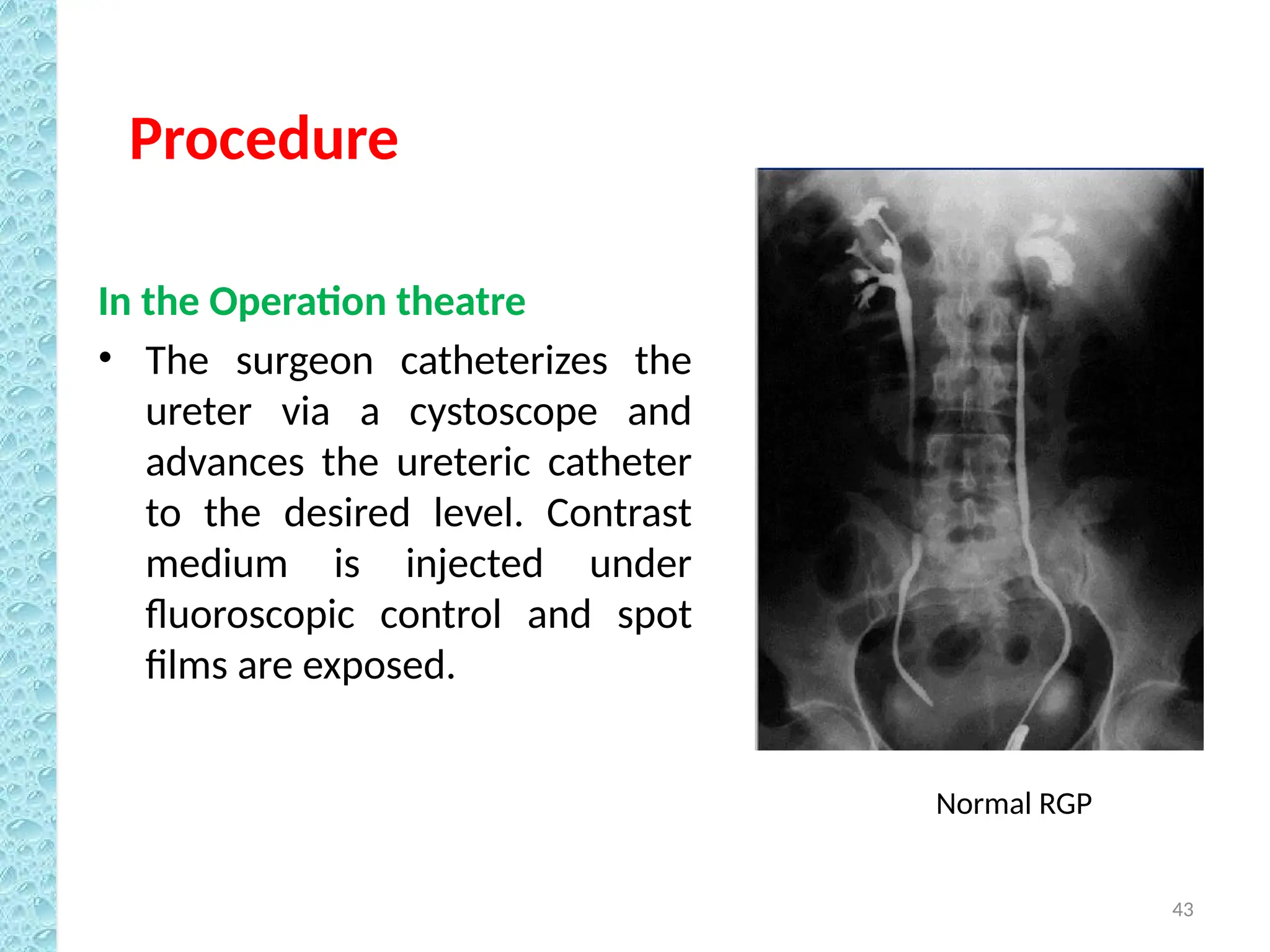 Urinary Tract Imaging by joginder .pptx