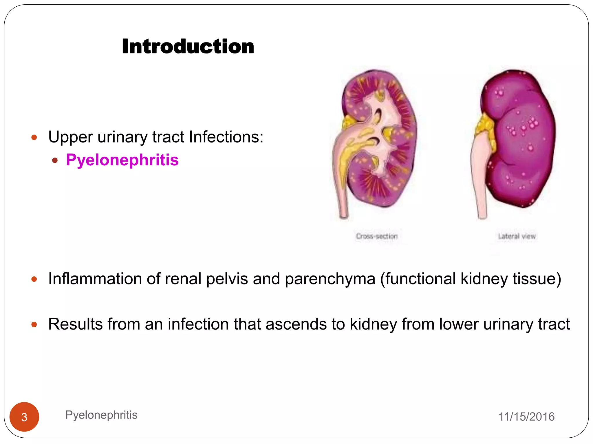 pyelonephirits | PPTX