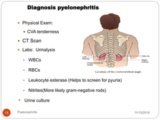 pyelonephirits | PPTX