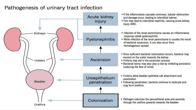 Urinary Tract Infection Before