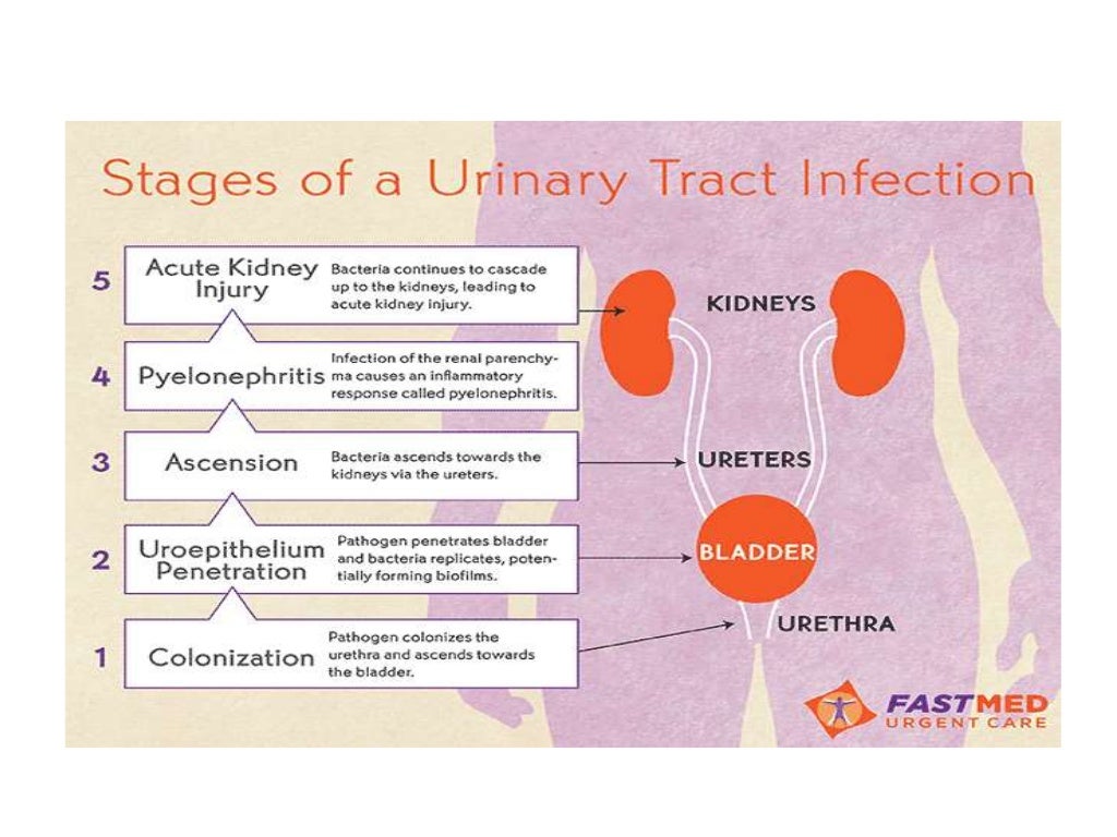 Urinary tract infection