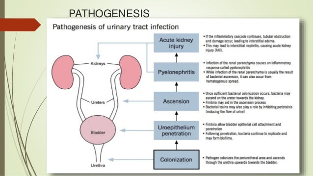 Urinary tract infection